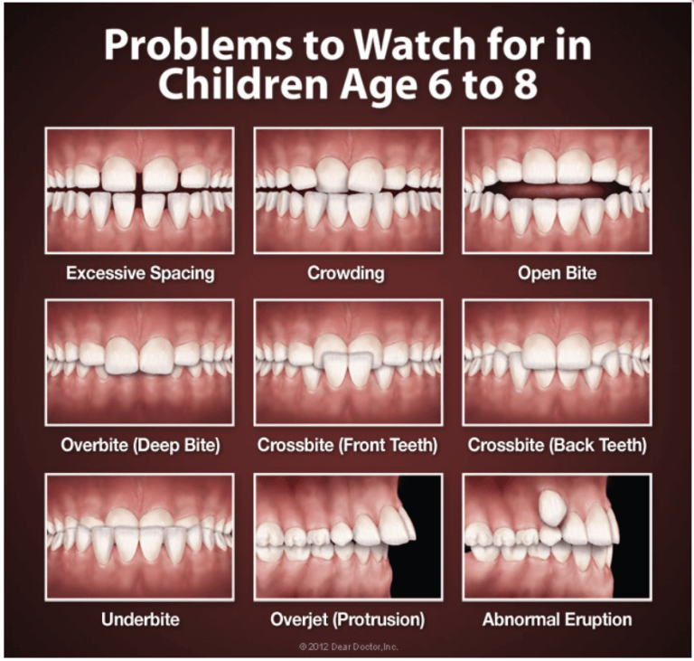 Orthodontics Overview - Boerne Orthodontics & Pediatric Dentistry